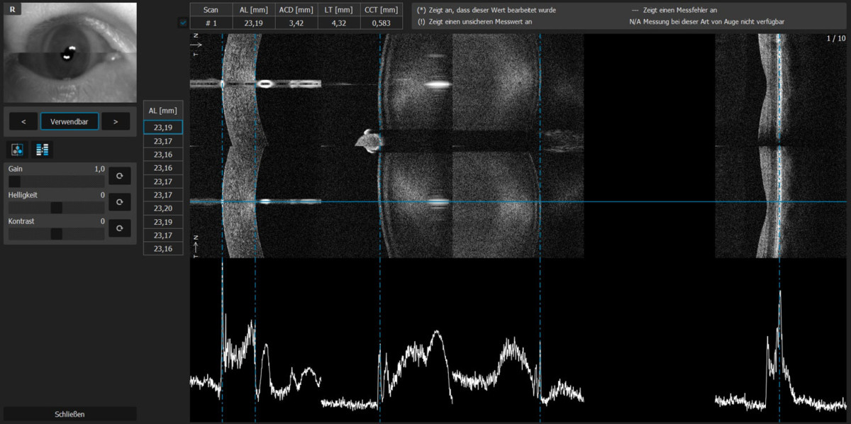 Modul Biometrie – mein OCT